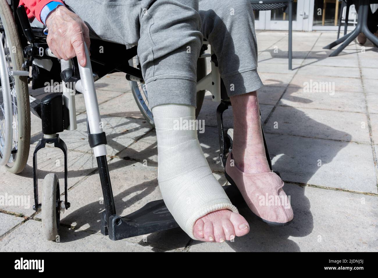 Cast ankle on an elderly person Fracture of the malleolus Stock Photo ...
