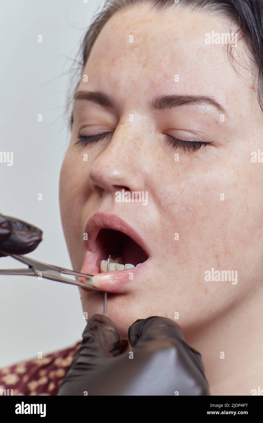 Tongue frenulum hi-res stock photography and images - Alamy