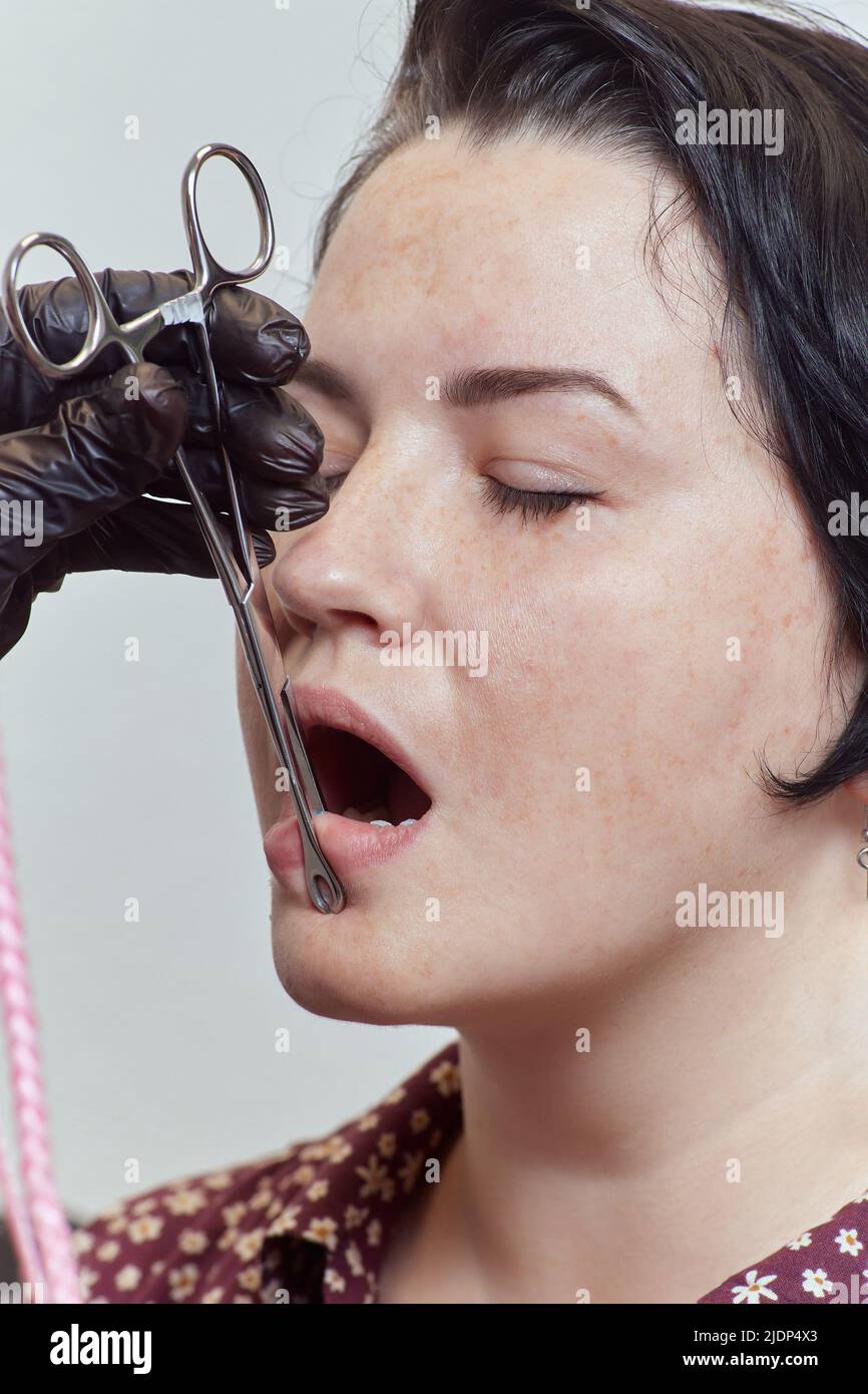 smile or frenulum piercing under the upper lip Stock Photo - Alamy