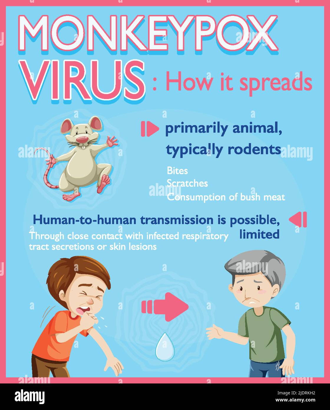 Monkeypox virus symptoms infographic illustration Stock Vector Image ...