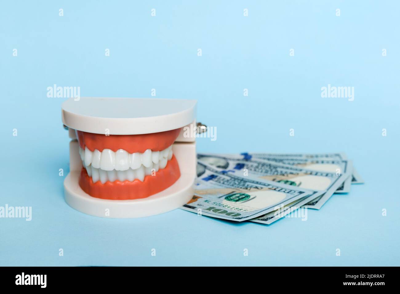 Closeup model of a human jaw with white teeth and dollar bill ...