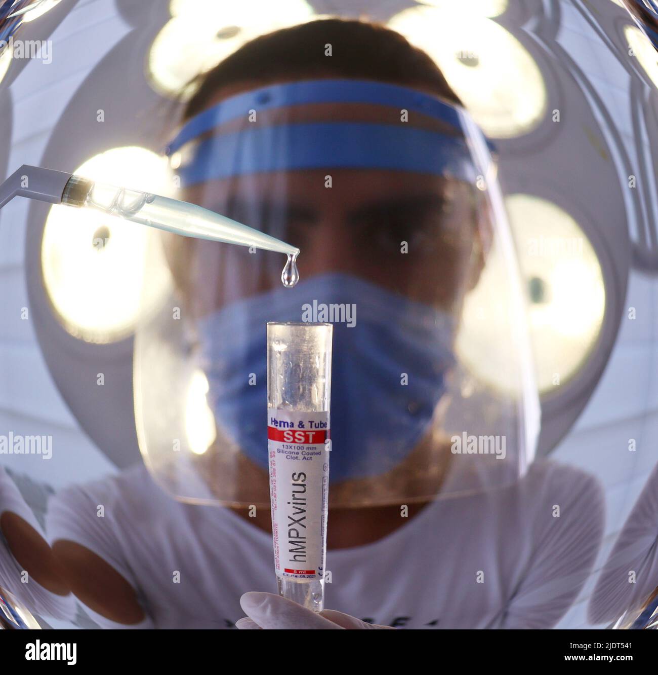 Smallpox lesions hi-res stock photography and images - Alamy