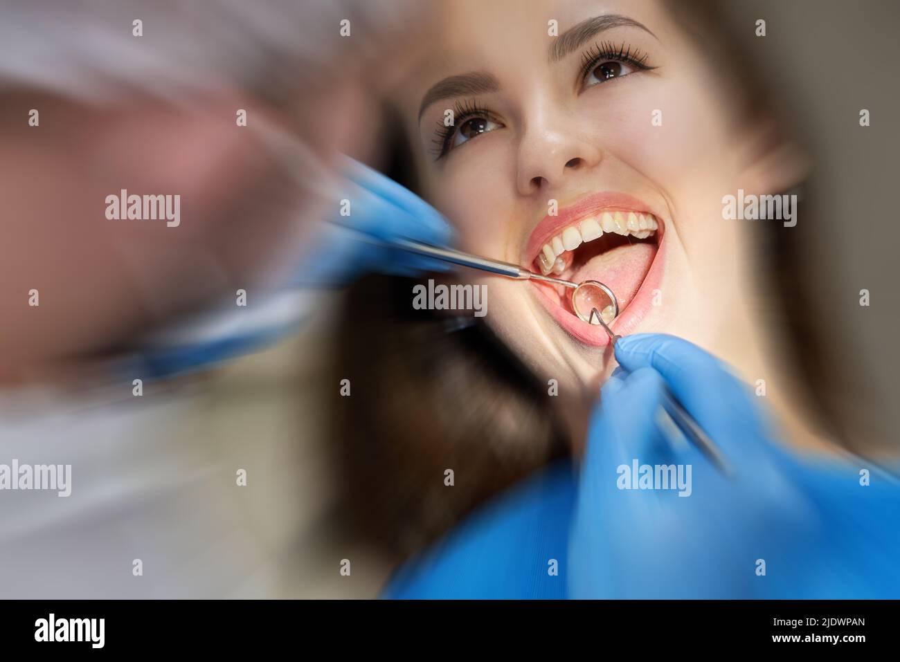 Woman having teeth check up at dentist office with motion blur effect ...