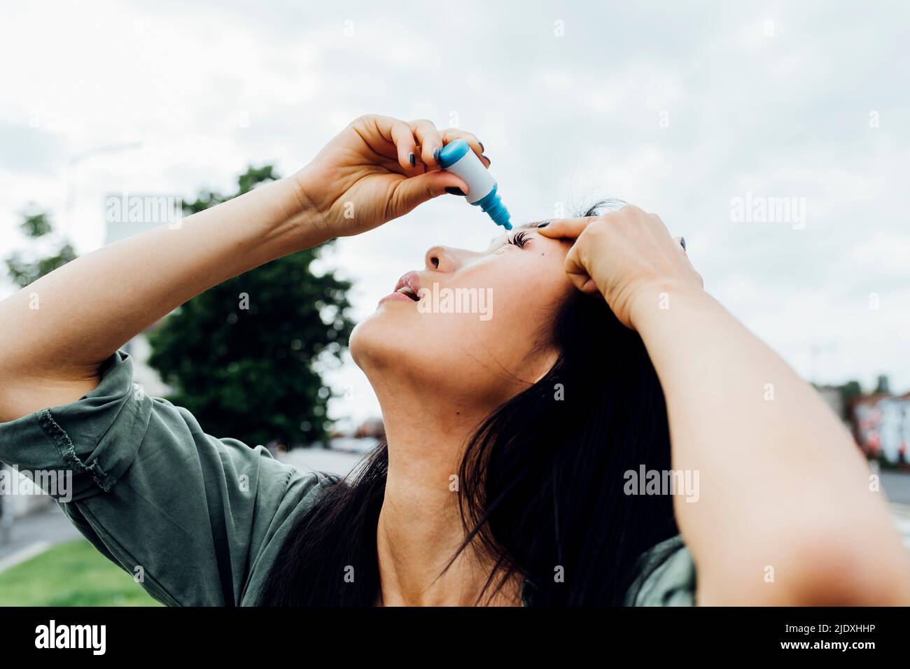 Young woman putting drop in eye Stock Photo - Alamy