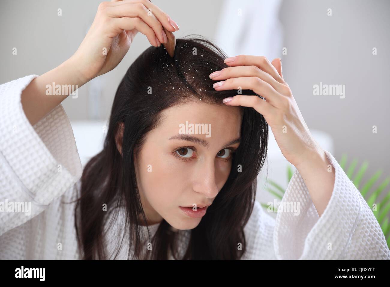 Young woman with problem of dandruff in bathroom Stock Photo - Alamy