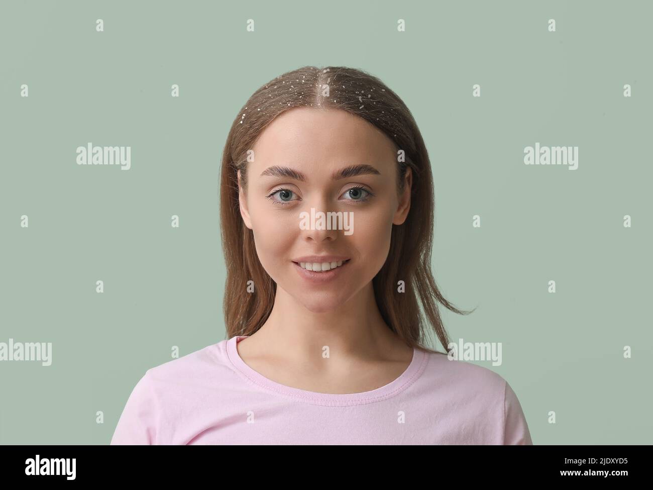 Young woman with problem of dandruff on green background Stock Photo ...