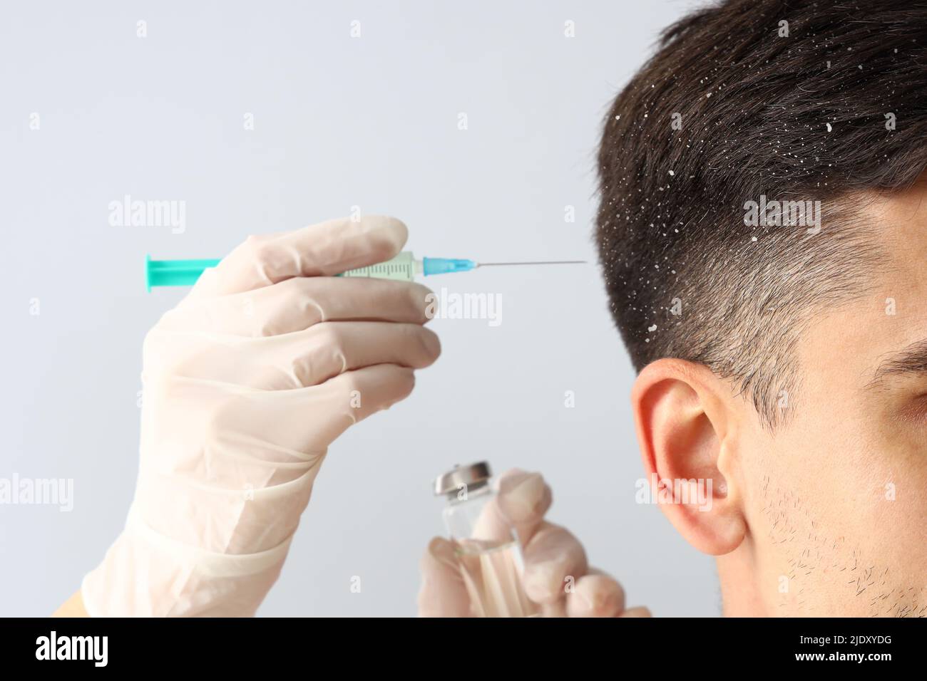 Young man with problem of dandruff receiving injection on light background, closeup Stock Photo ...