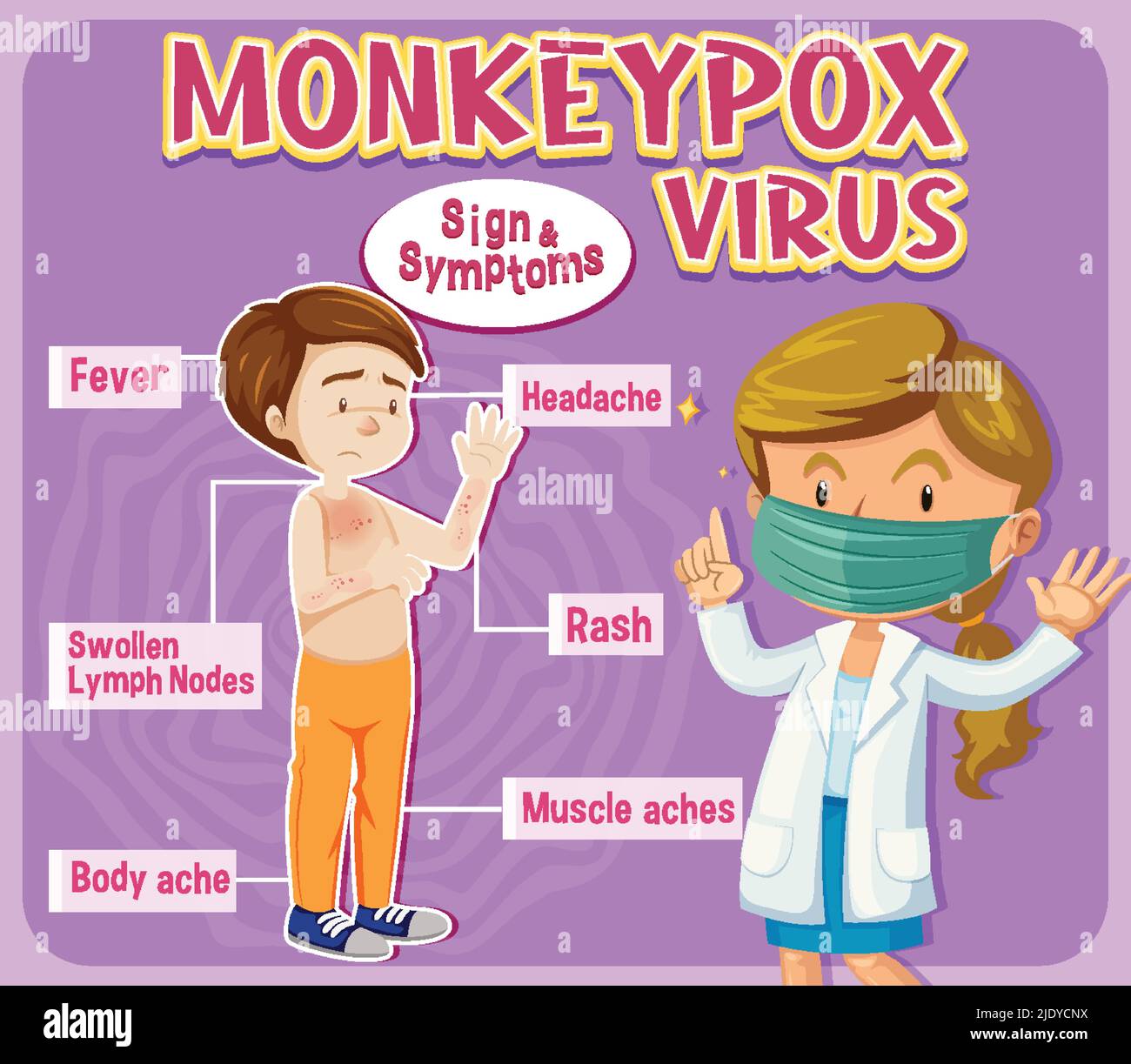 Monkeypox virus sign and symptoms infographic illustration Stock Vector ...
