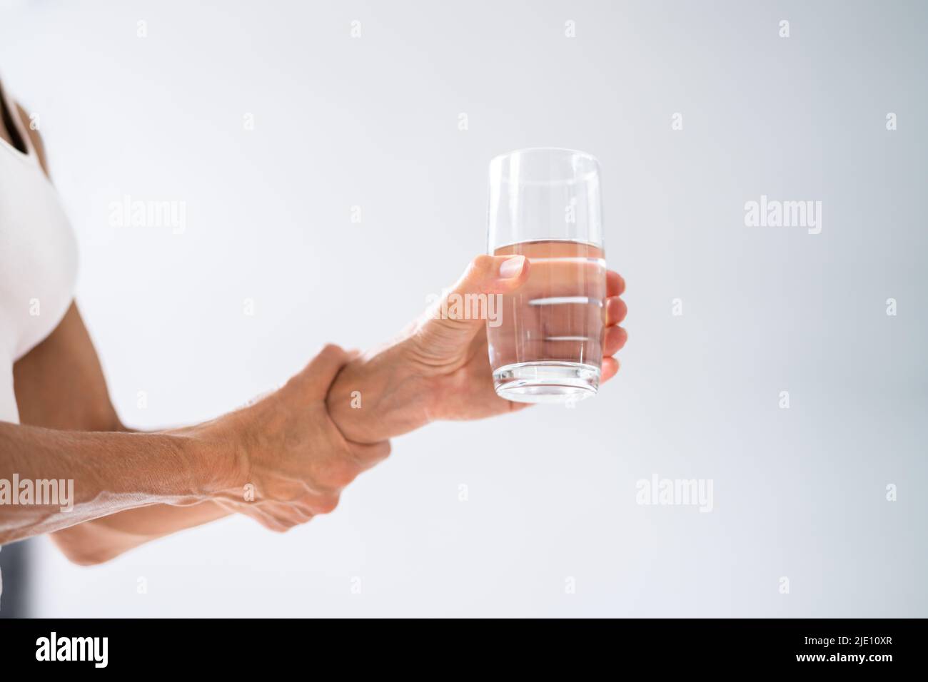 Person Hand With Dystonia. Degenerative Aging Movement Stock Photo - Alamy