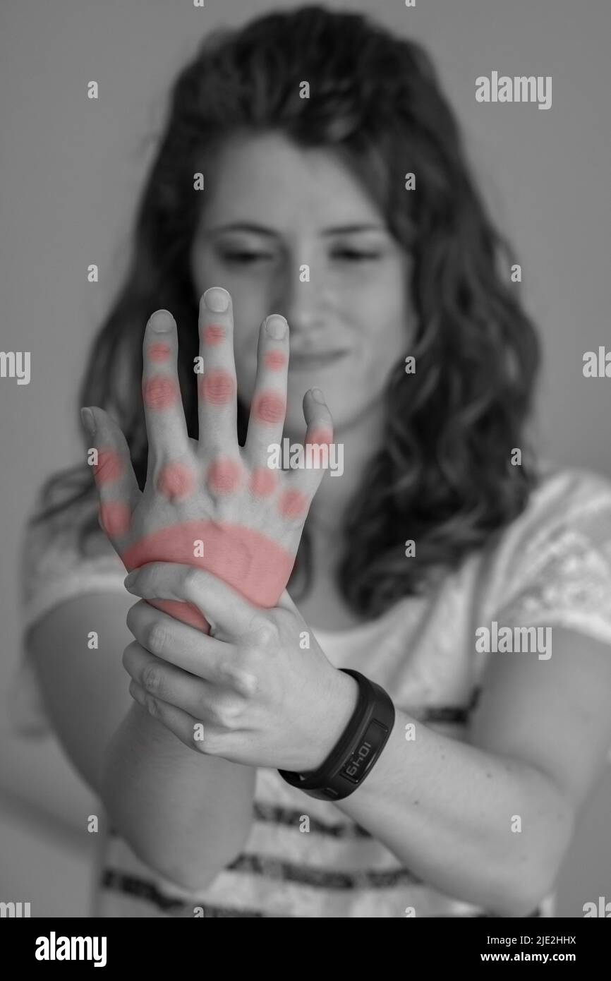 Woman with arthritis in the hands. Black and white with sore joints highlighted in red Stock ...