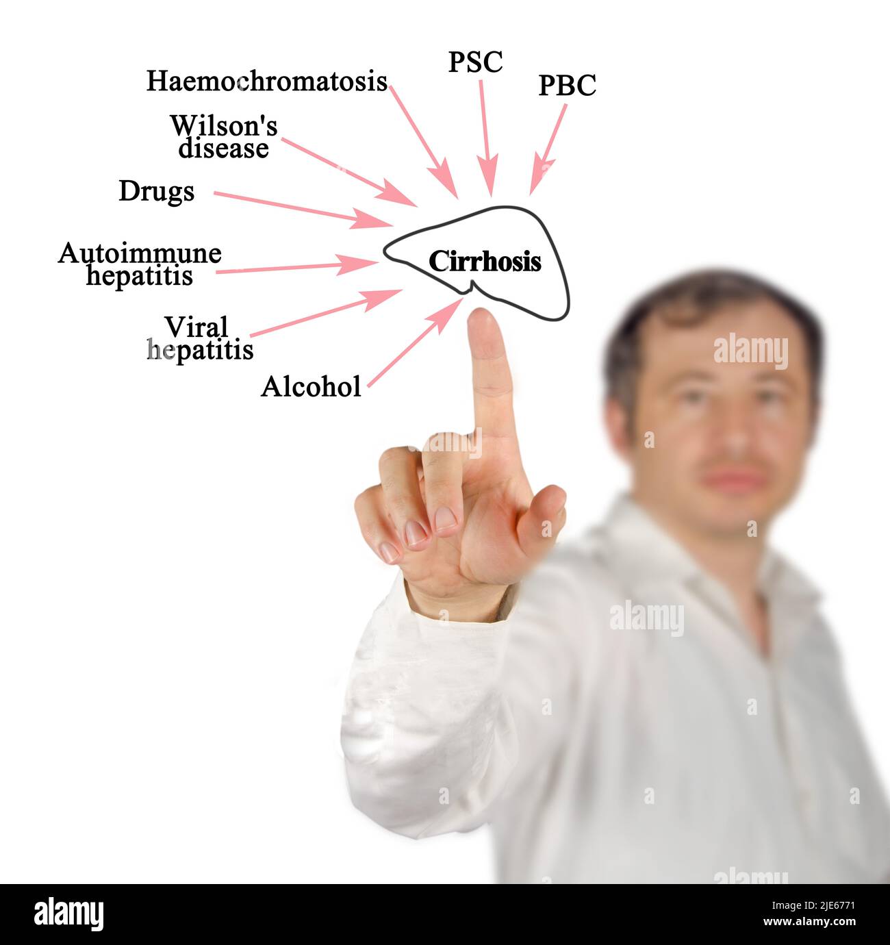 Eight major causes of Cirrhosis Stock Photo - Alamy Eight major causes of Cirrhosis Stock Photo - Alamy