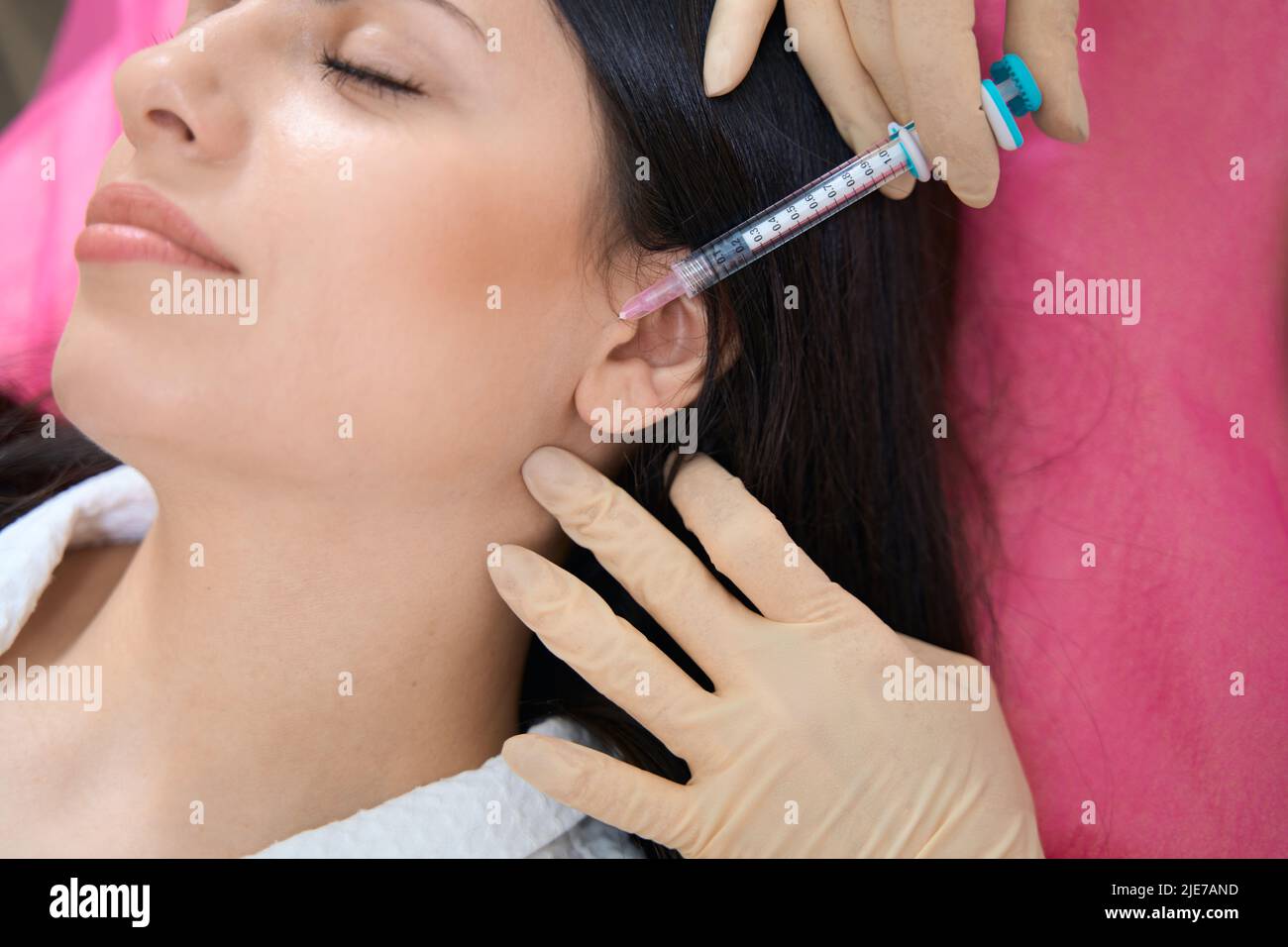 Close up of mesotherapy injections to improve facial skin Stock Photo ...
