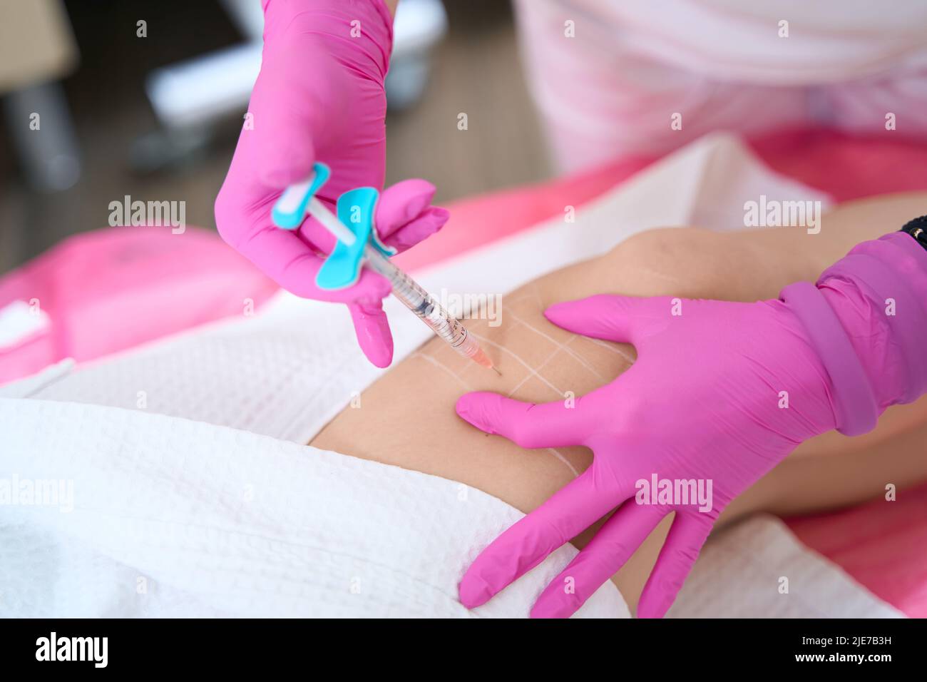 Injection for skin tightening and preventing the formation of folds and ...