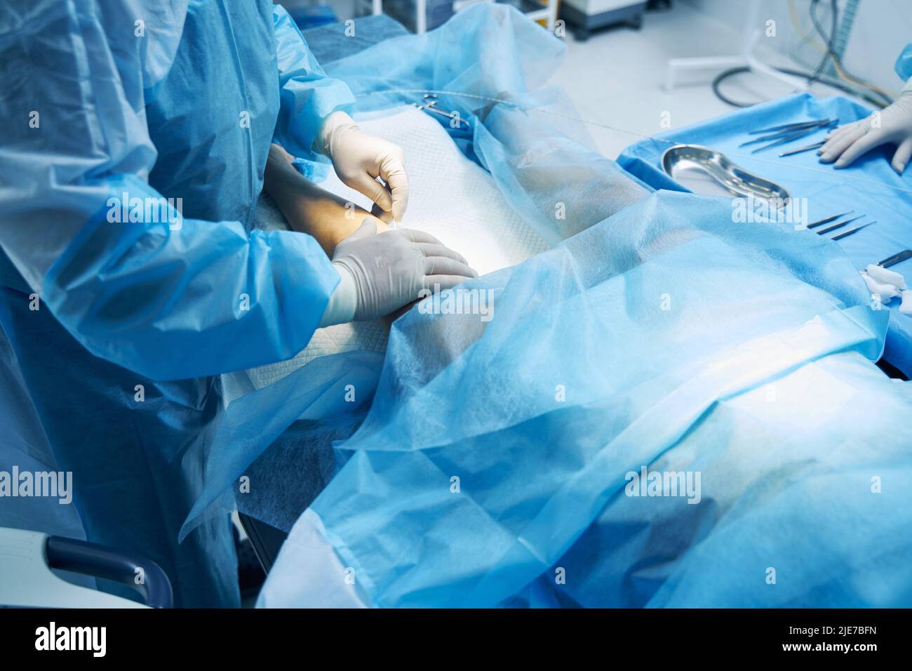 Laser operation of lower limb varicose veins Stock Photo - Alamy
