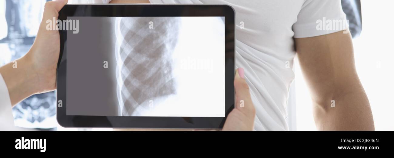 Medical worker put tablet device on patients body part and see ribs ...