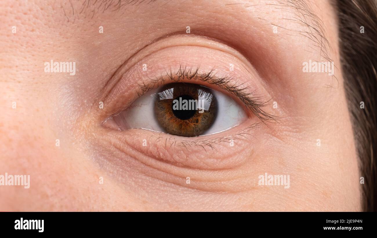 Corneal disease hi-res stock photography and images - Alamy