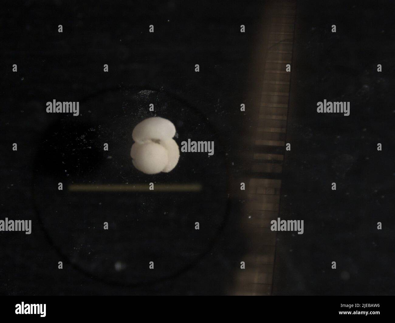 Foraminiferida forams hi-res stock photography and images - Alamy