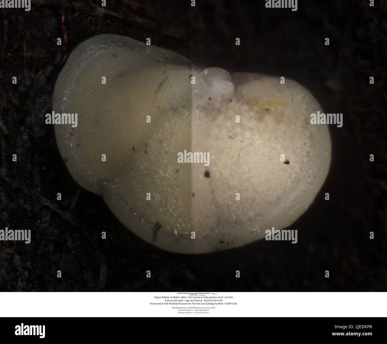 Globorotalia tumida brady hi-res stock photography and images - Alamy