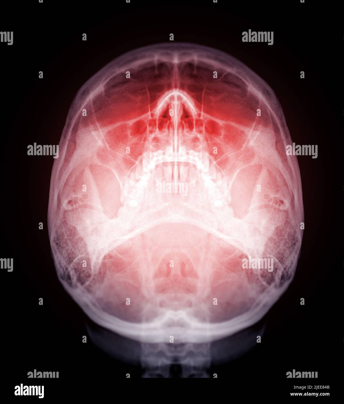Skull x-ray image of Human skull water view isolated on Black ...