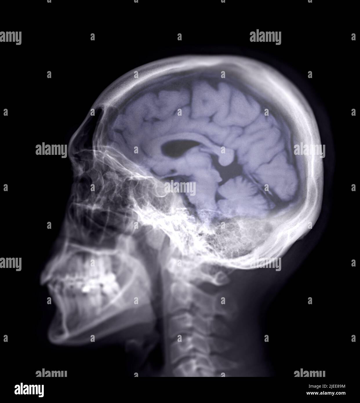 Cross section of the head lateral view hi-res stock photography and ...