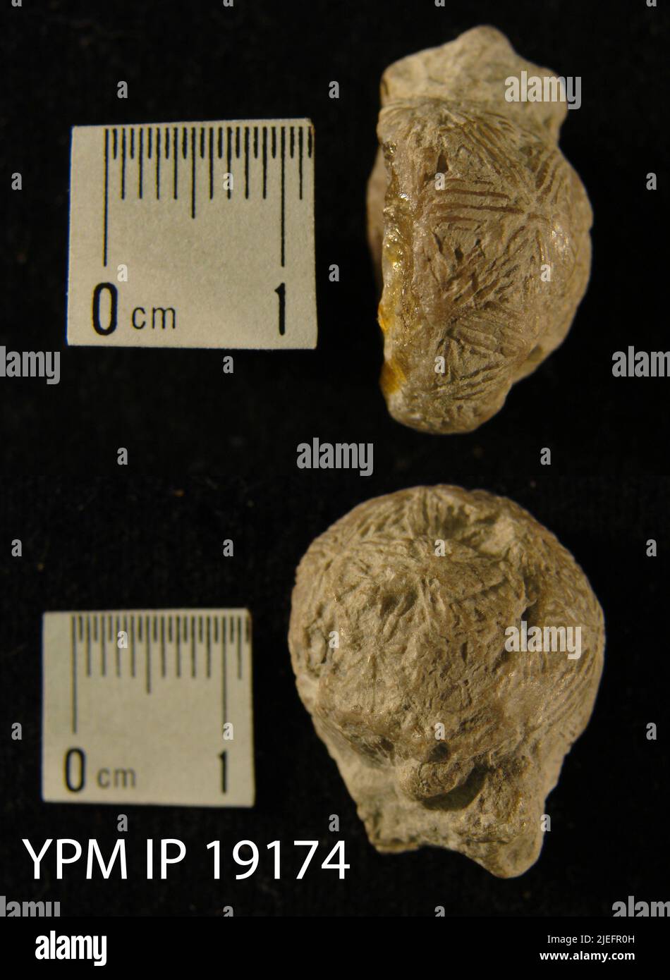 Cysto hi-res stock photography and images - Alamy