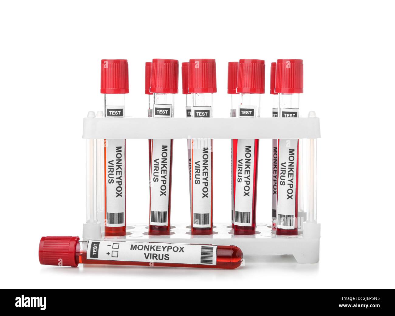 Test tubes with blood samples on white background. Monkeypox virus ...