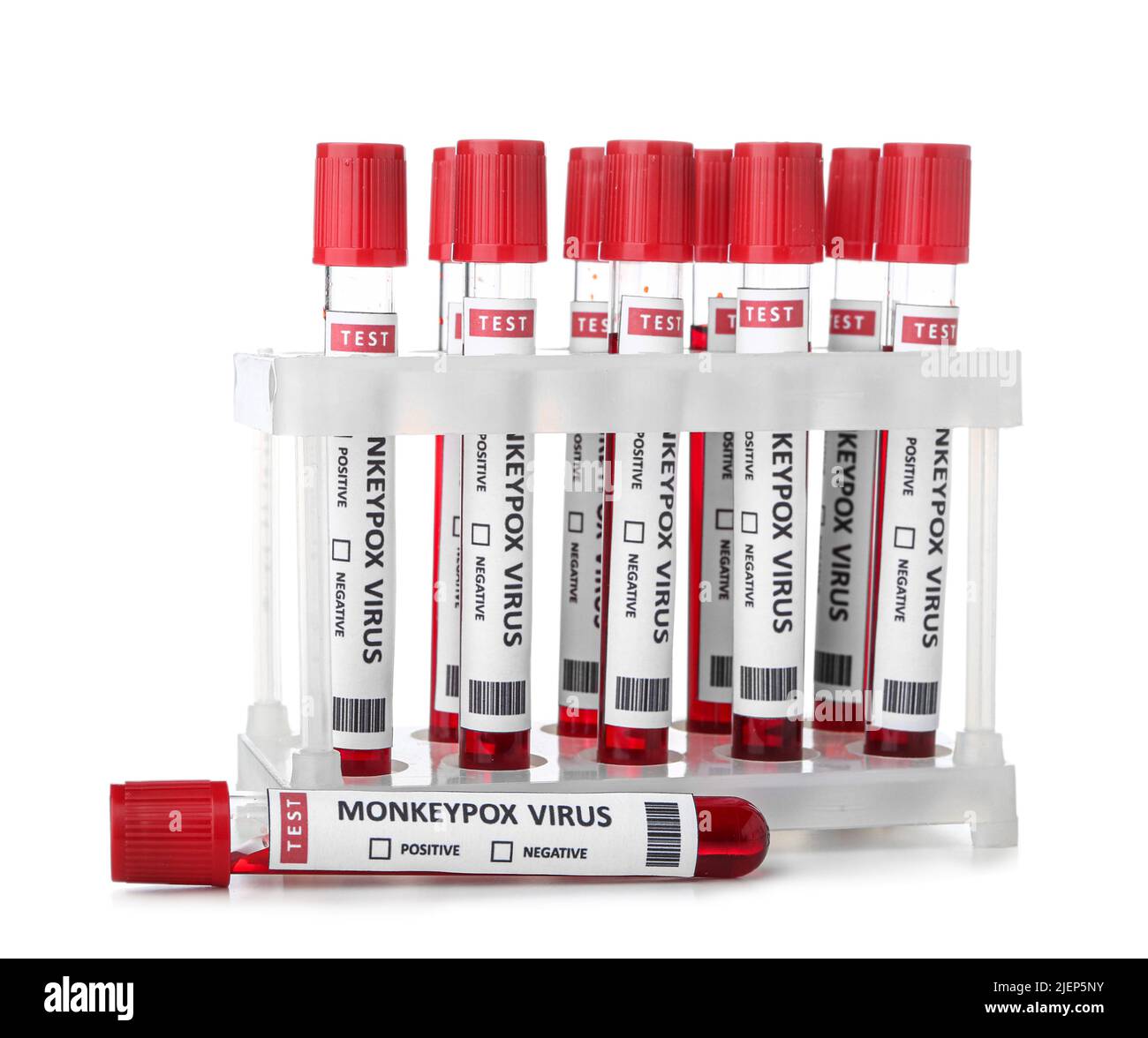 Test tubes with blood samples on white background. Monkeypox virus ...