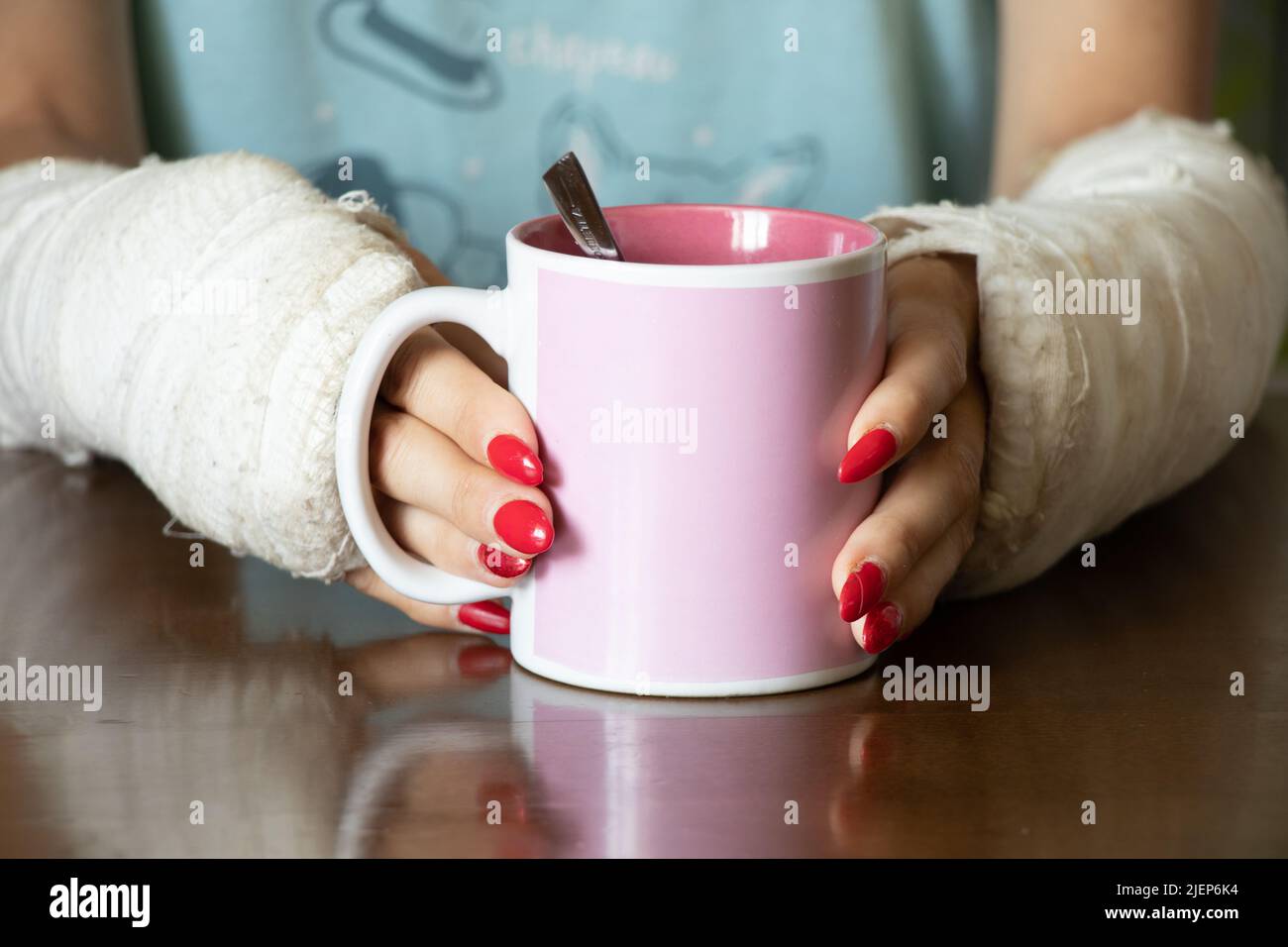 Bone fracture plaster hi-res stock photography and images - Alamy