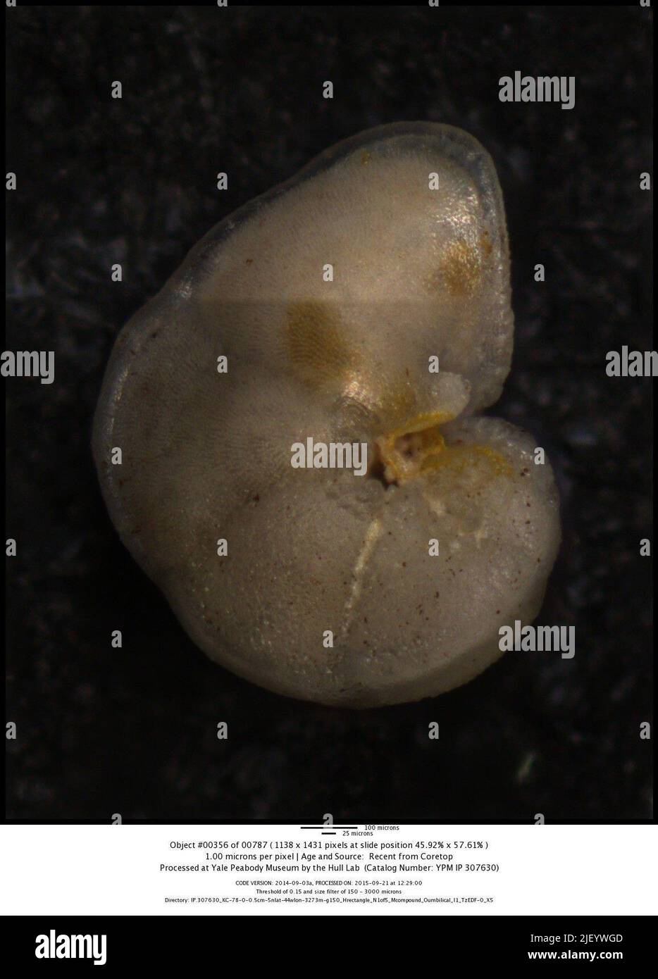 Globorotalia tumida brady hi-res stock photography and images - Alamy