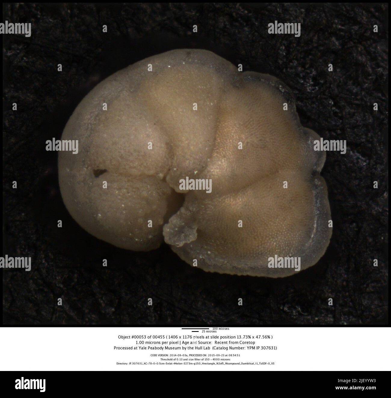 Globorotalia tumida (Brady, 1877 Stock Photo - Alamy
