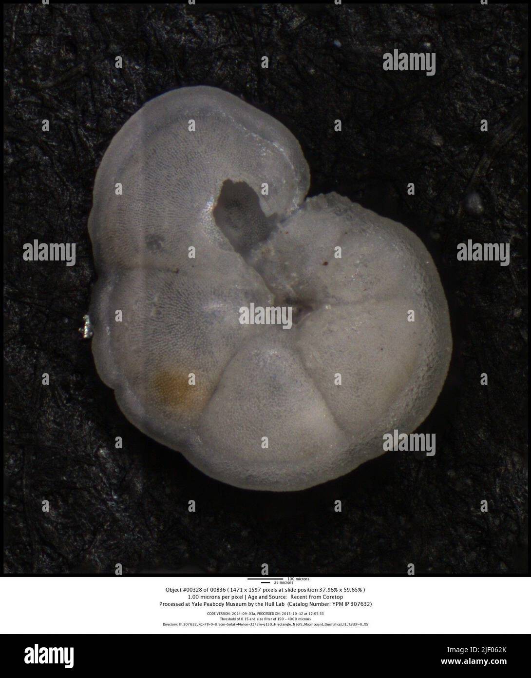 Undet foraminiferida protista hi-res stock photography and images - Alamy