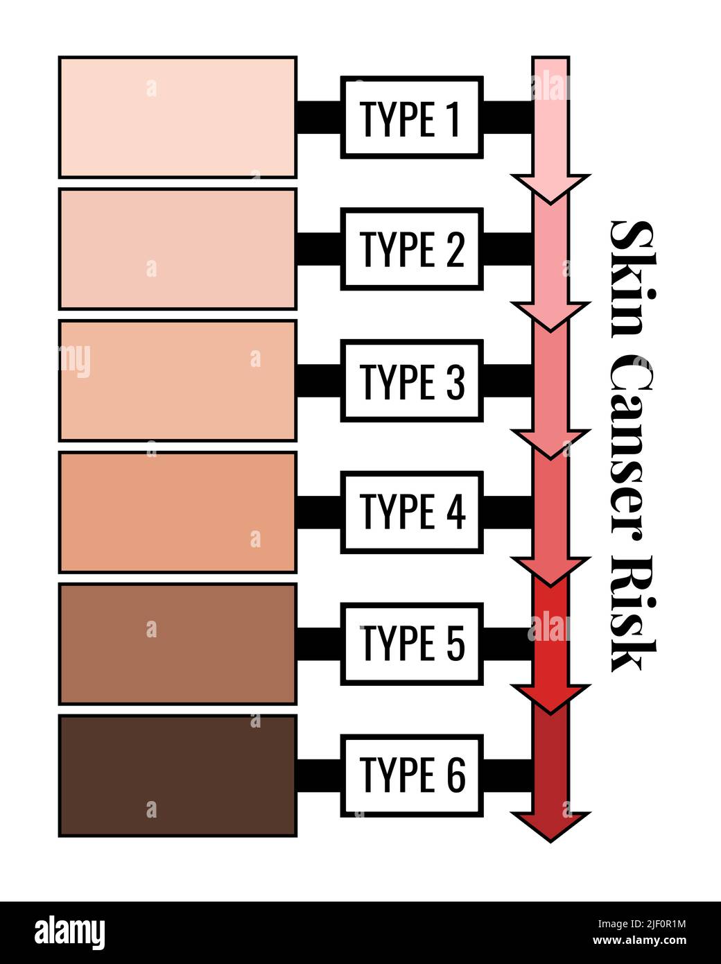 Fitzpatrick skin phototype scale with cancer risk dependence Stock ...