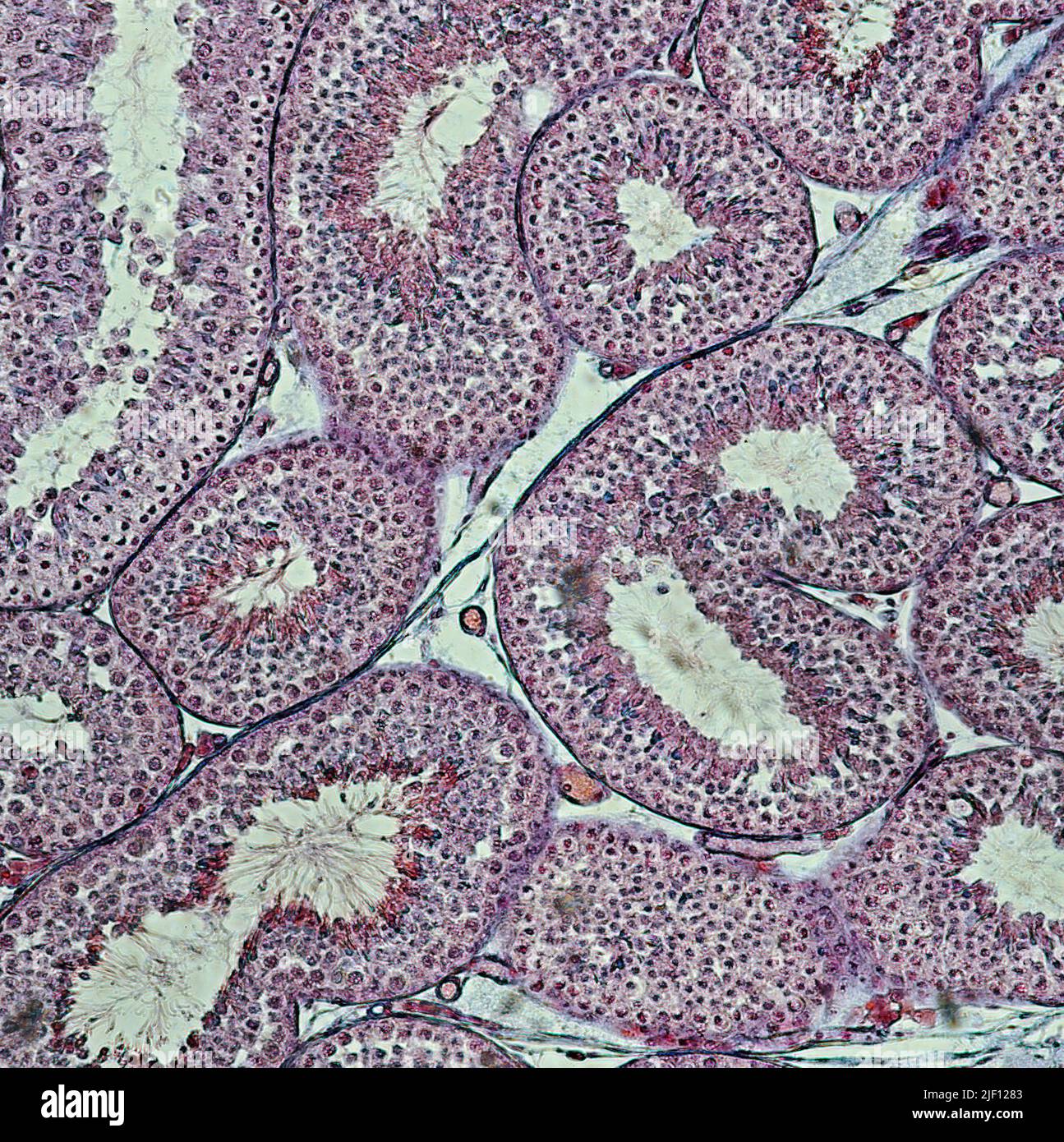 Human testicle hi-res stock photography and images - Alamy