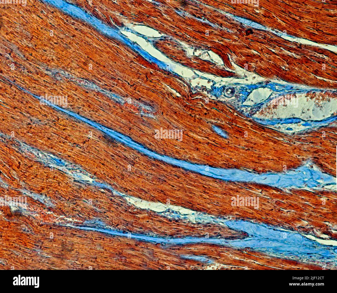 Cardiac Muscle Cell Structure Branching