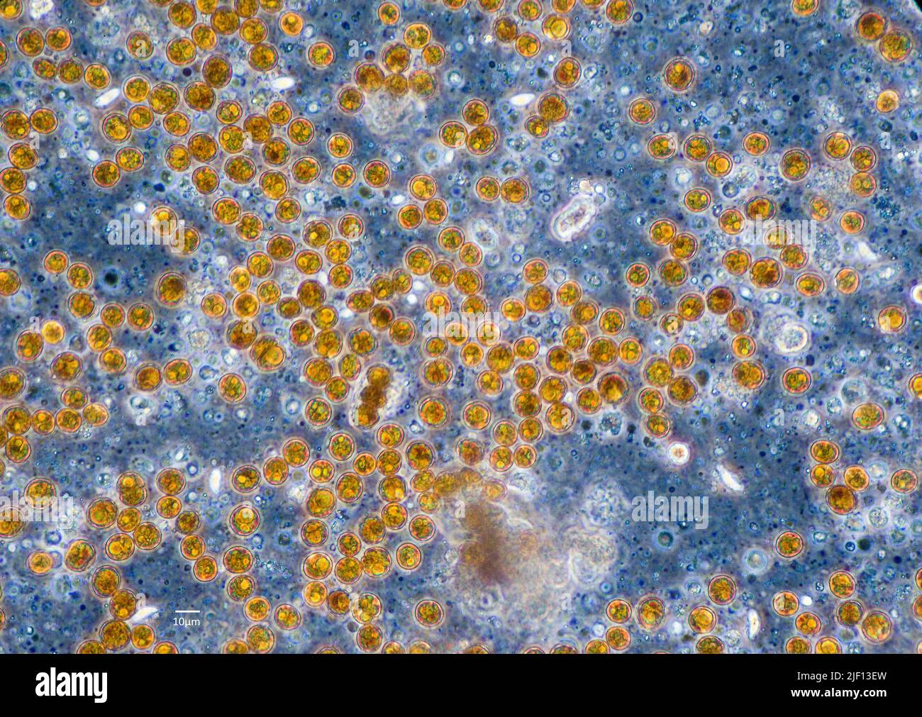 Microscopic photo of symbiotic algae (zooxanthellae) of the ...