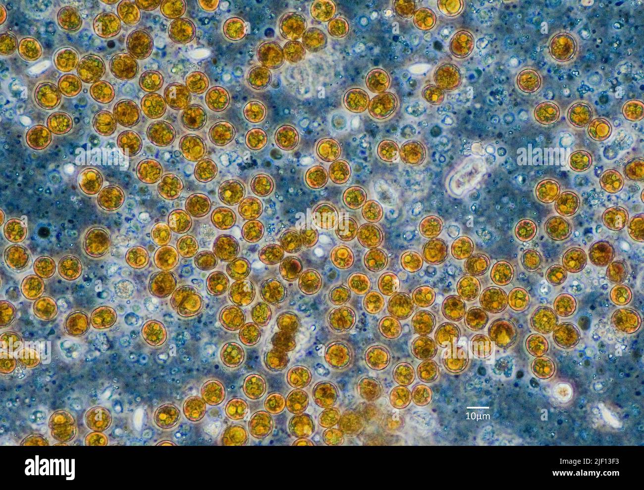 Microscopic photo of symbiotic algae (zooxanthellae) of the ...
