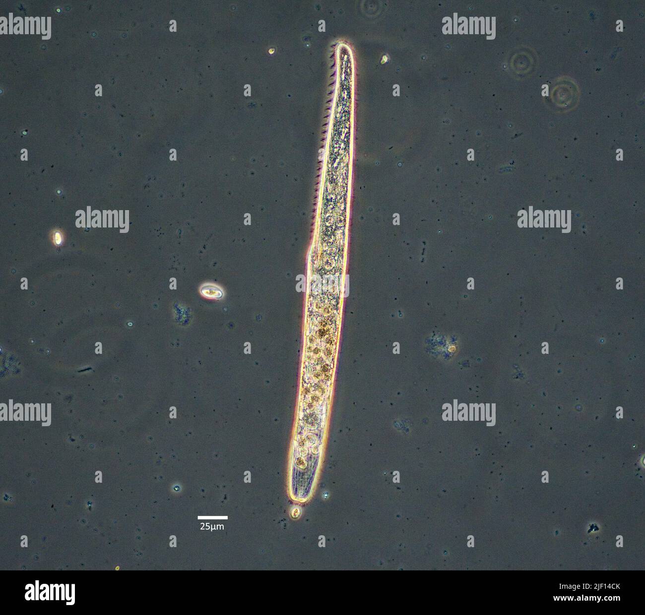 Unicellular ciliate from the genus Dileptus. Photo from a freshwater ...