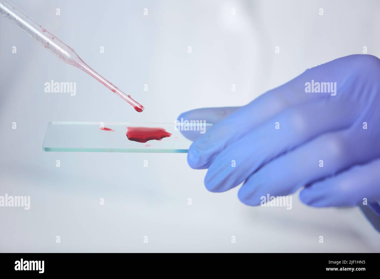 Close-up of unrecognizable lab worker in rubber gloves dropping blood ...