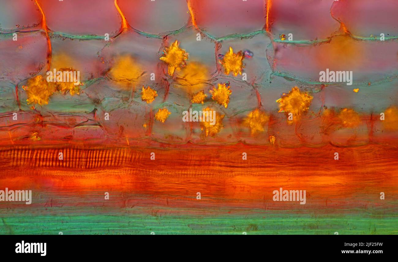 Calcium oxalate crystals (druse) in garden rhubarb (Rheum rhabarbarum ...