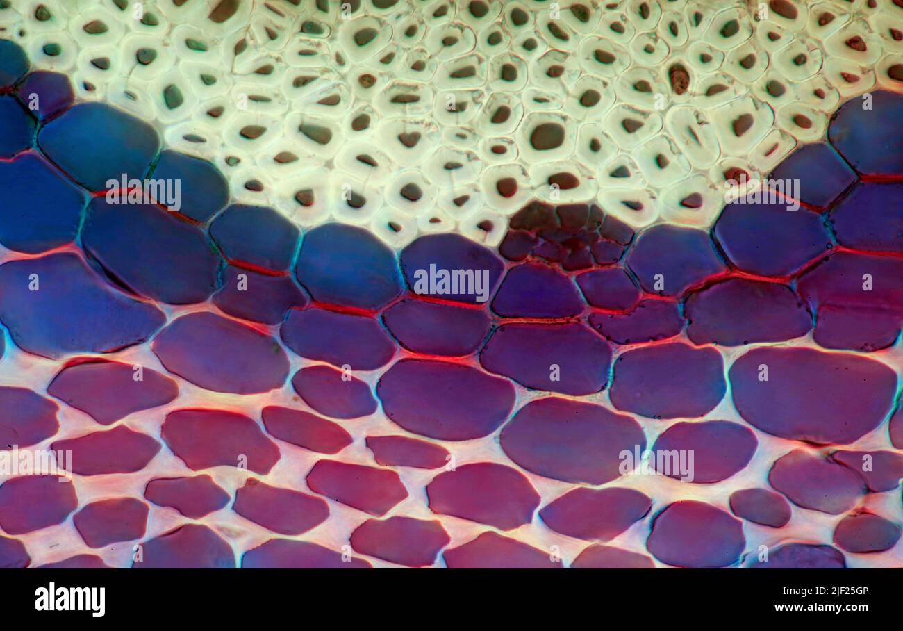 Polarized light micrograph of Sclerenchyma and angular collenchyma in ...