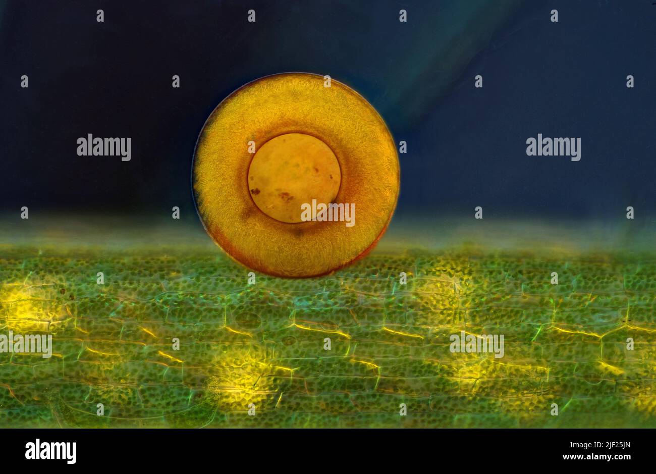 Polarized light micrograph of Arcella sp., a shelled amoeba on aquatic ...