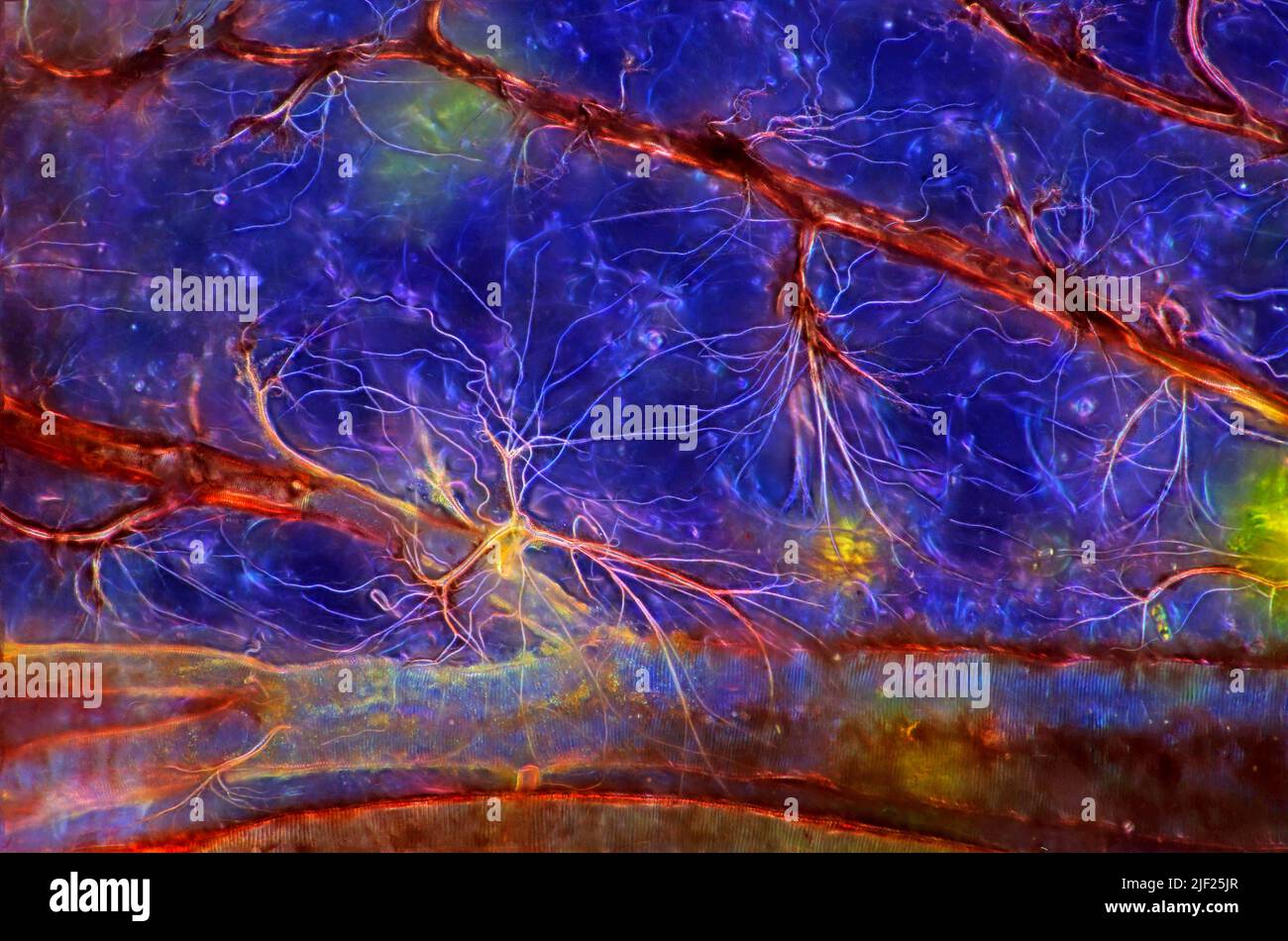Polarized dark field and light micrograph of tracheae and tracheoles in ...