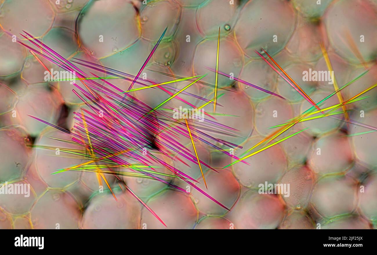 Polarised light micrograph of a transverse cross section through the ...