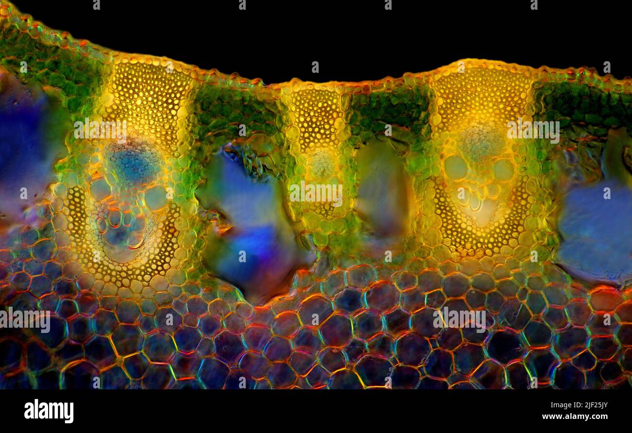 Dark field light micrograph of a transverse cross section through the ...
