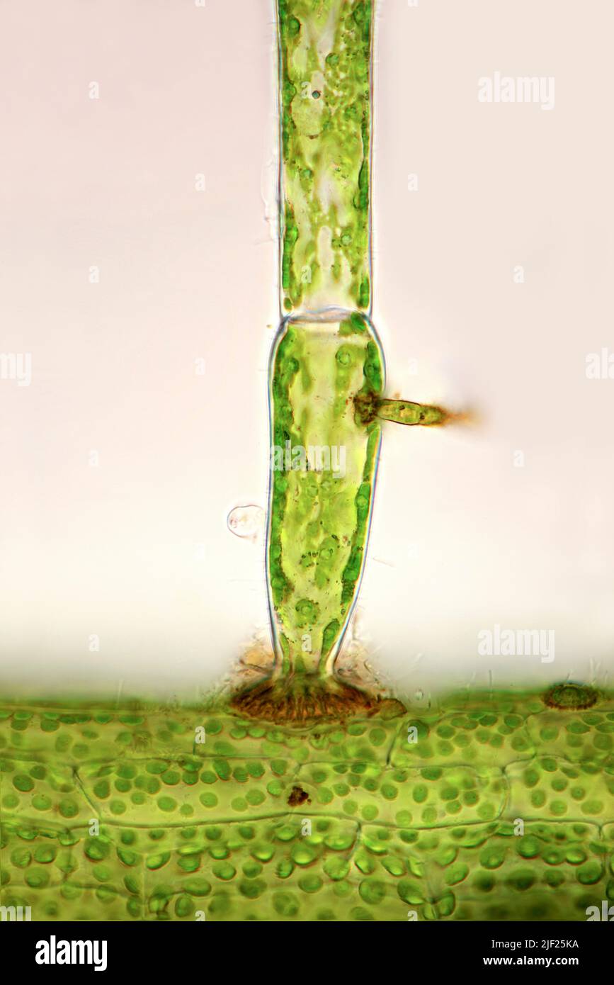 Bright field light micrograph of green alga on an aquatic plant ...