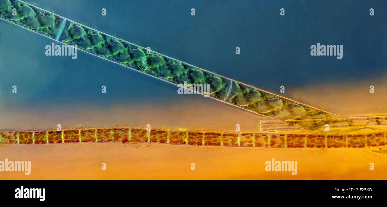 Polarized light micrograph of Sirogonium sp. green algae and Melosira ...