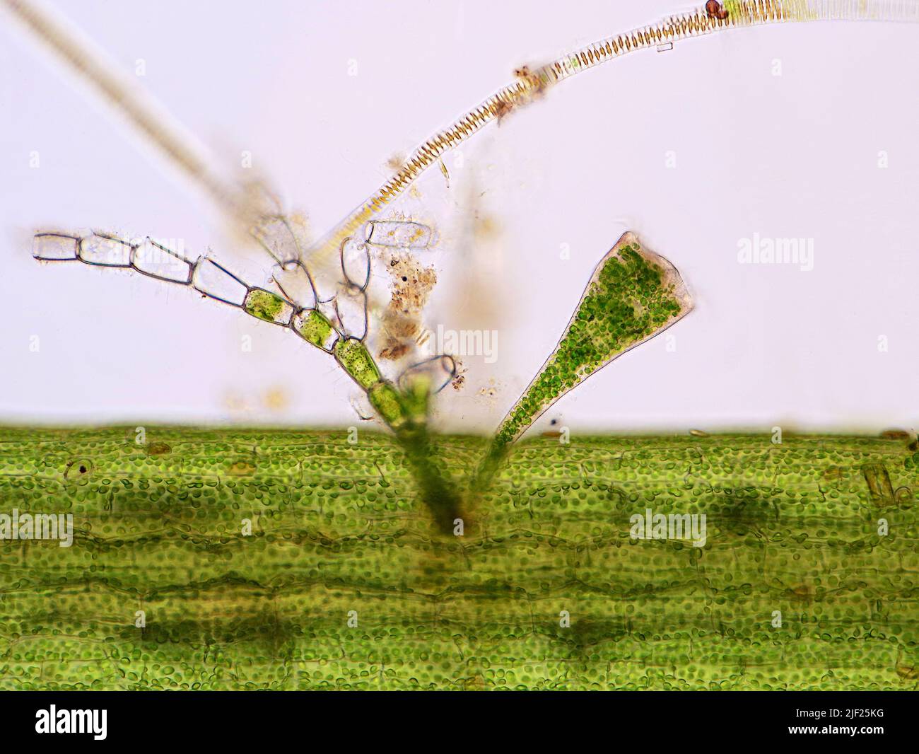 Bright field light micrograph of Algae and Stentor sp. ciliate settled ...
