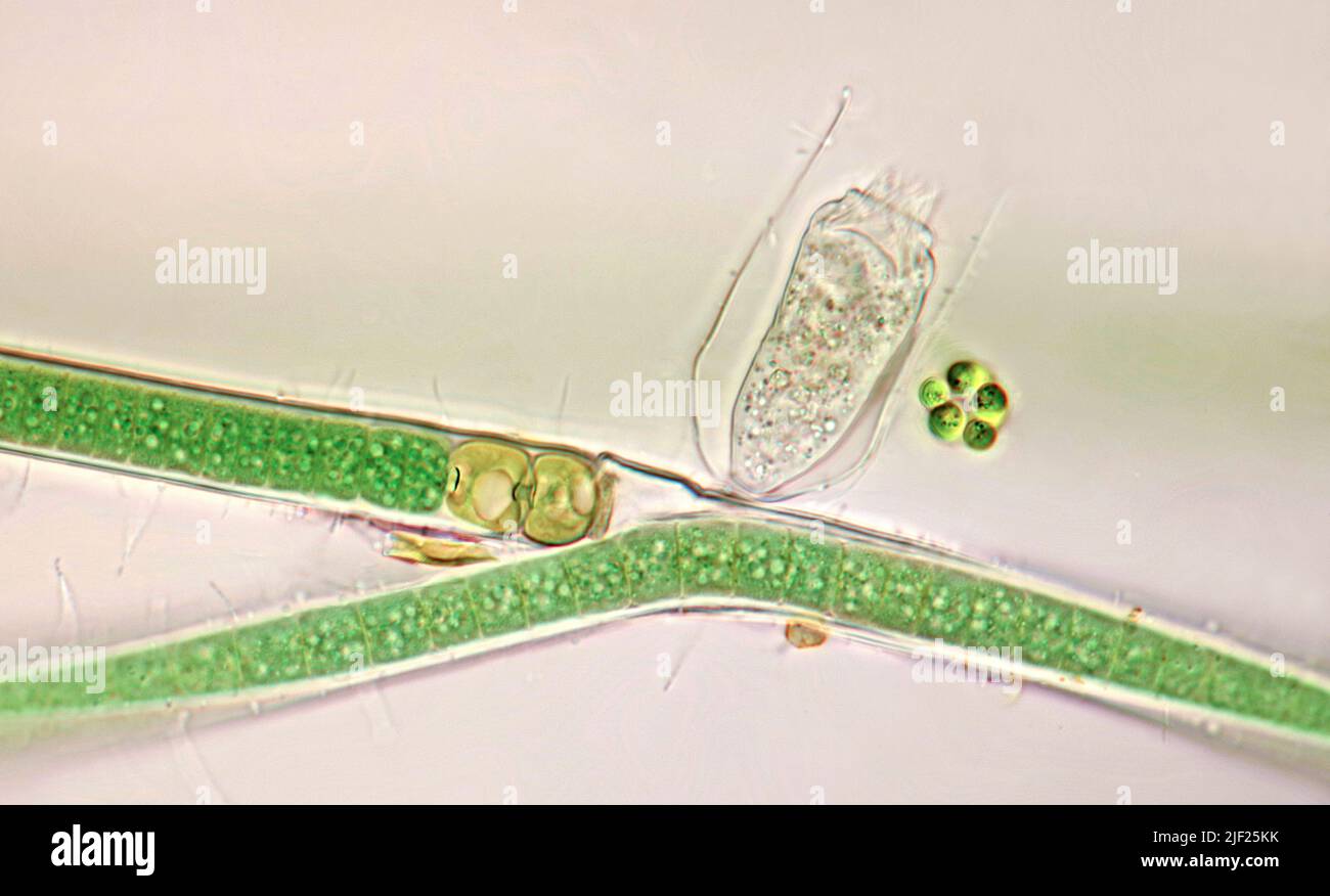 Bright field light microgrpah of Vaginicola sp. ciliate settled on ...