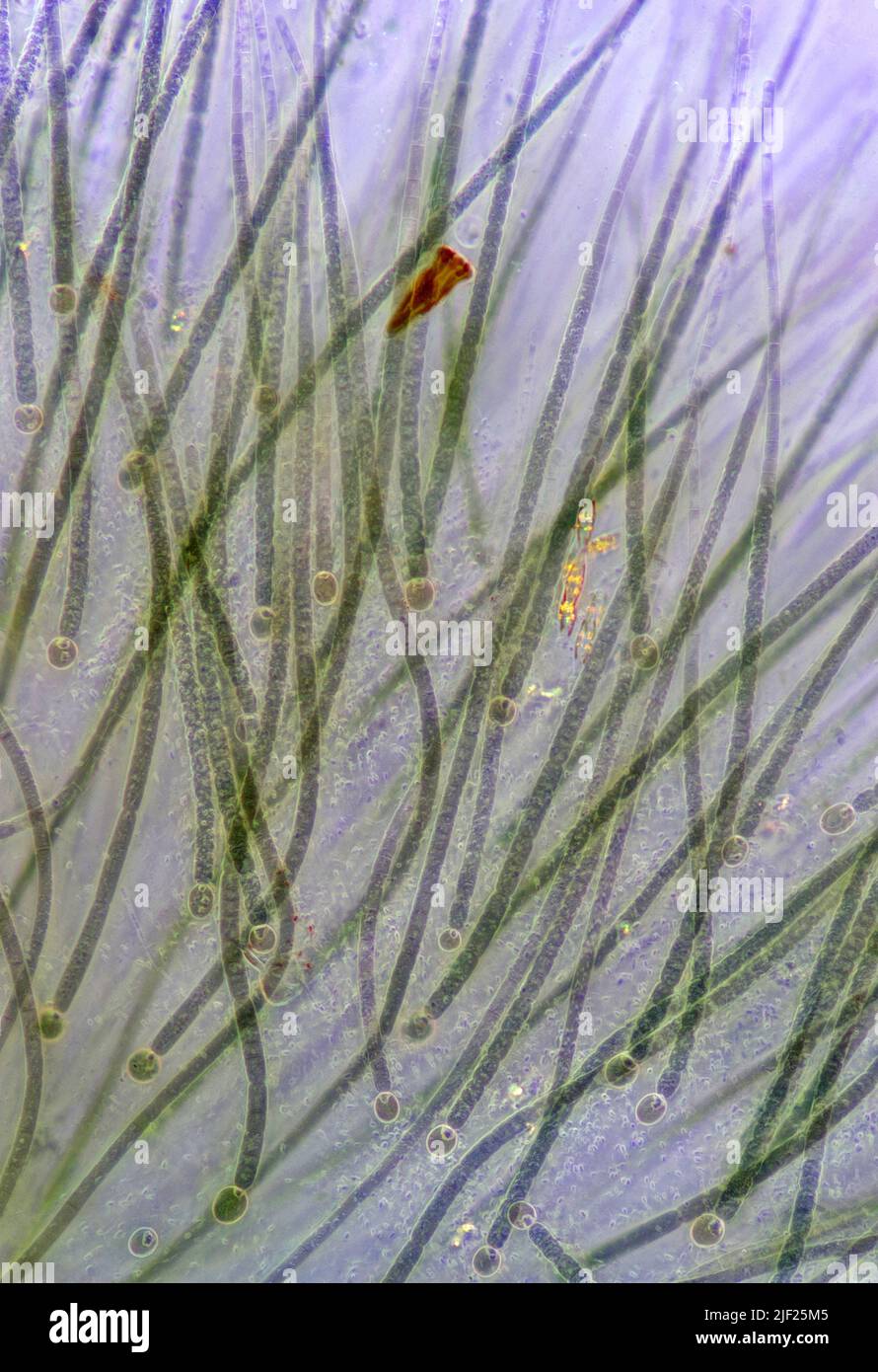 Polarised light micrograph of Rivularia cyanobacteria. Magnification ...