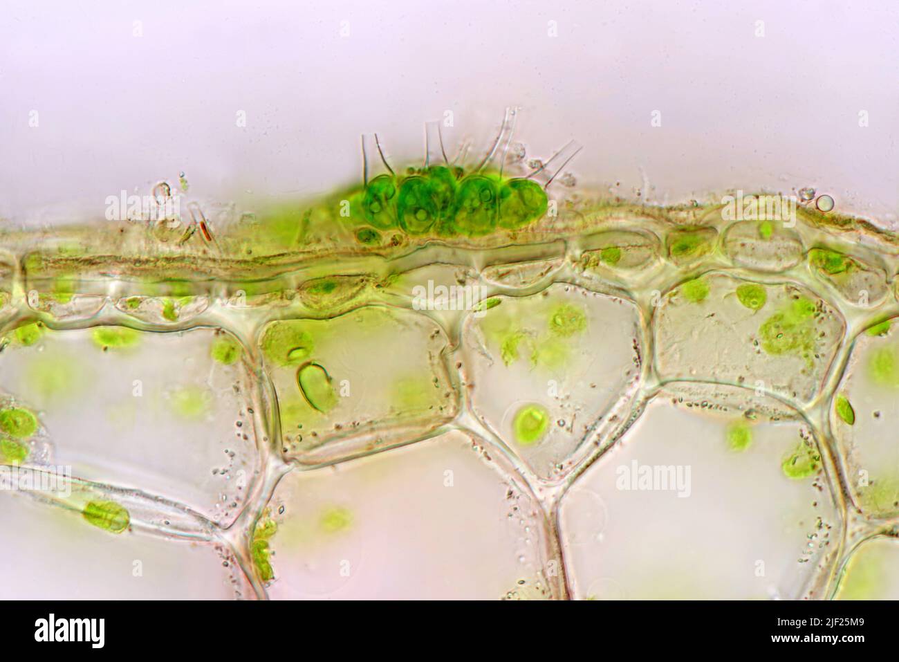 Bright field light micrograph of Aphanochaete green algae on ...